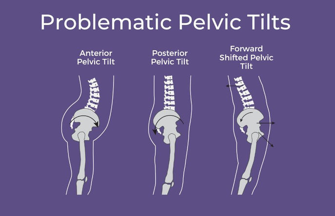 Rehabilitate Pelvic Floor, Back & Balance New – Fluidity